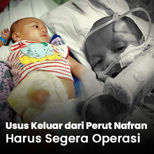 Usus Nafran Berada di Luar Perut! Bantu Anak Pembersih Sekolah Melalui ...