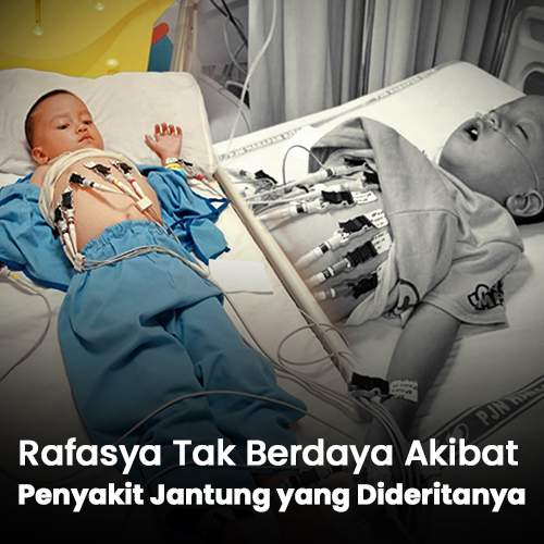Operasi Jantung Satu-satunya Jalan Rafasya Bisa Bertahan Hidup ...