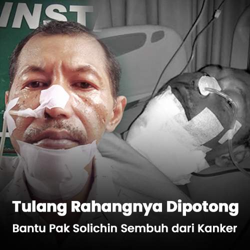 Pak Solichin Melawan Kanker Rahang Ganas - BenihBaik.com
